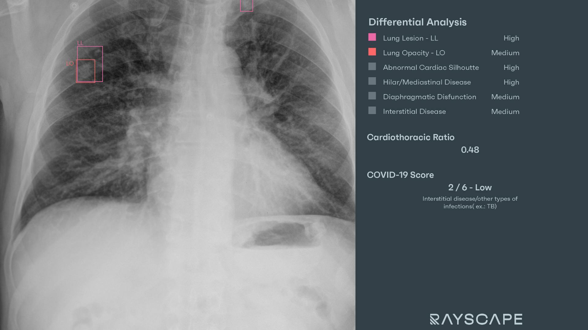 Rayscape | Radiology AI