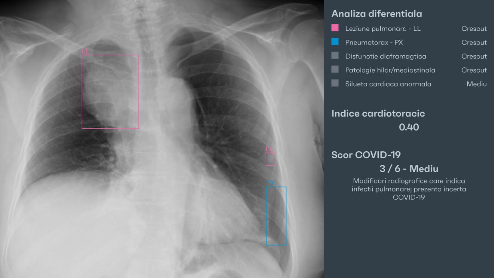Rayscape | Chest XRay