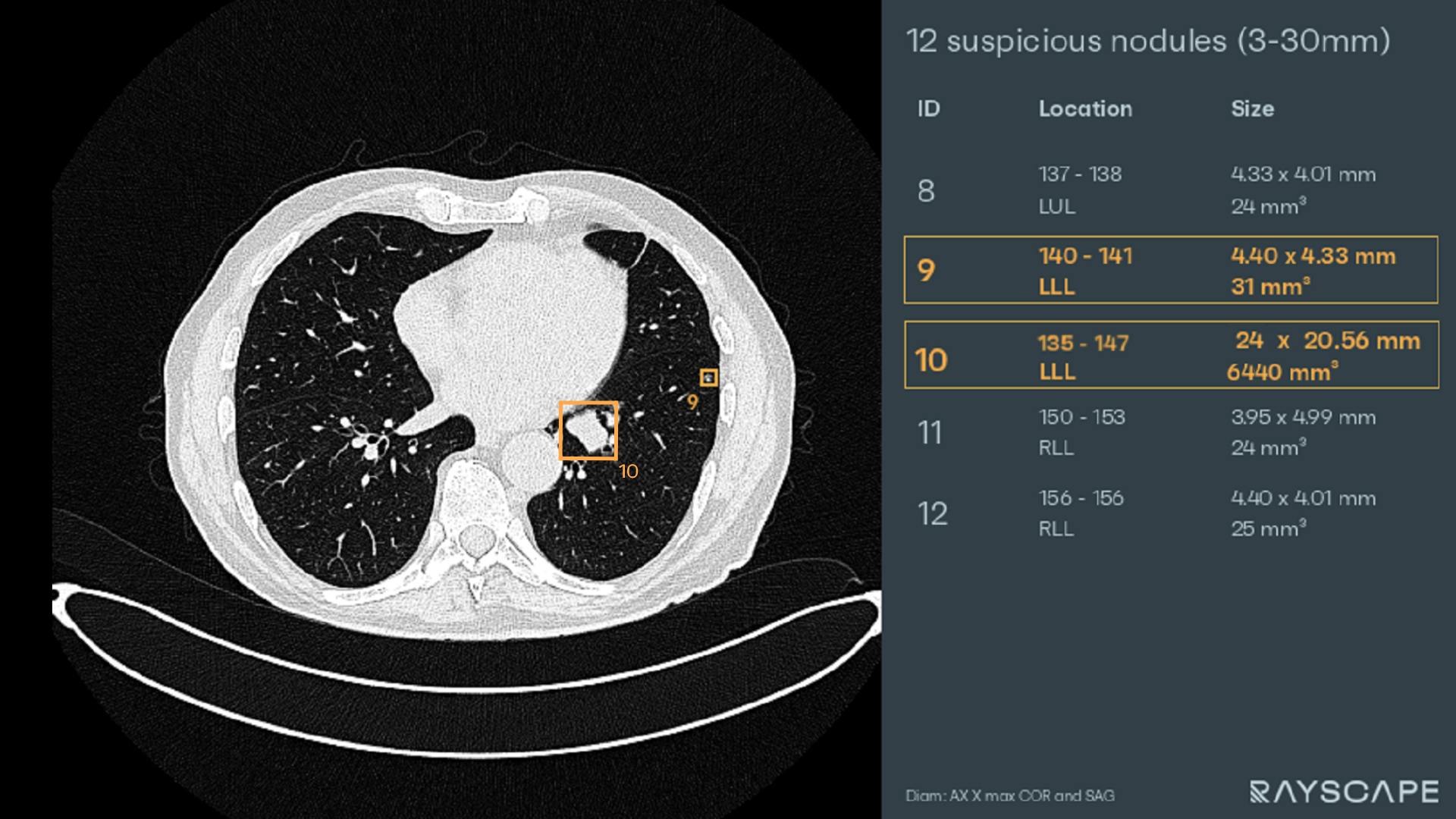 Rayscape | Radiology AI