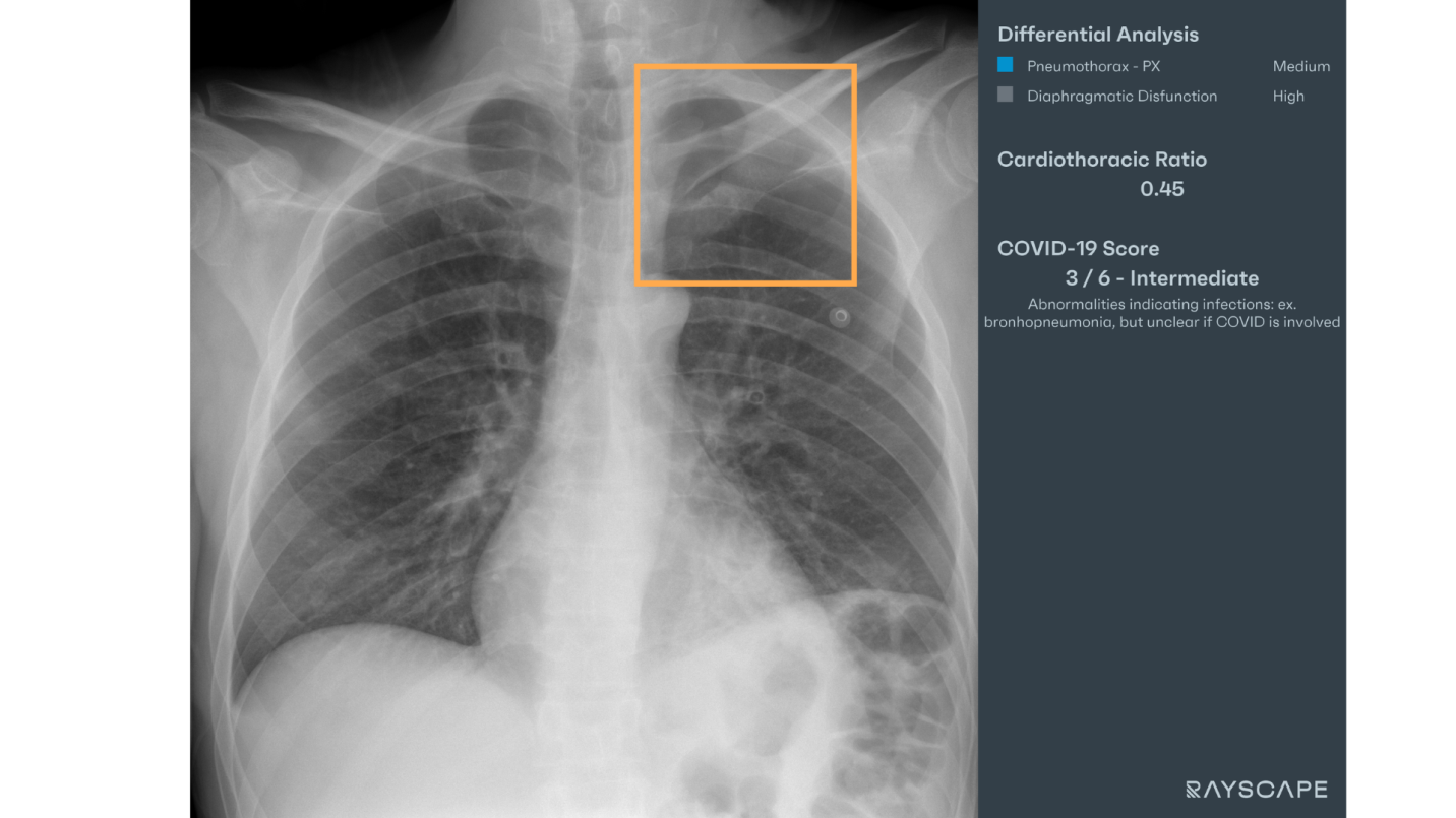Rayscape | Chest XRay