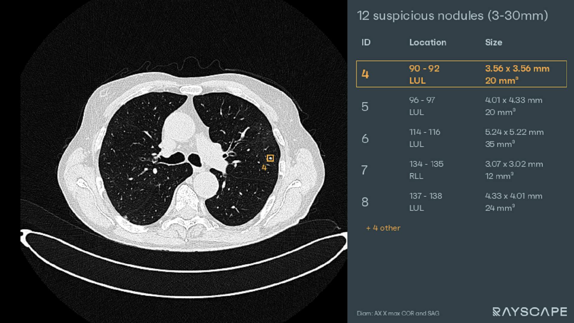 Rayscape | Radiology AI