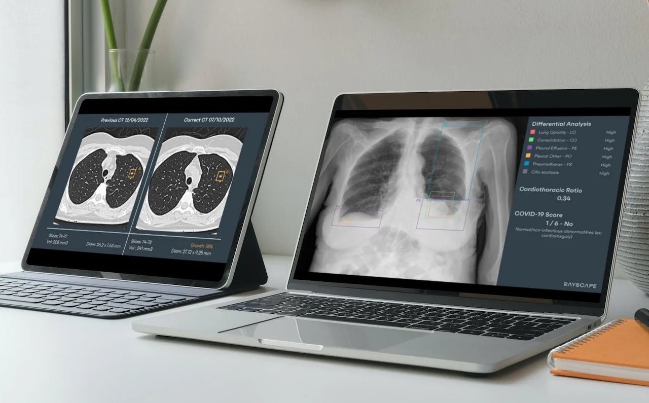 Rayscape | Radiology AI