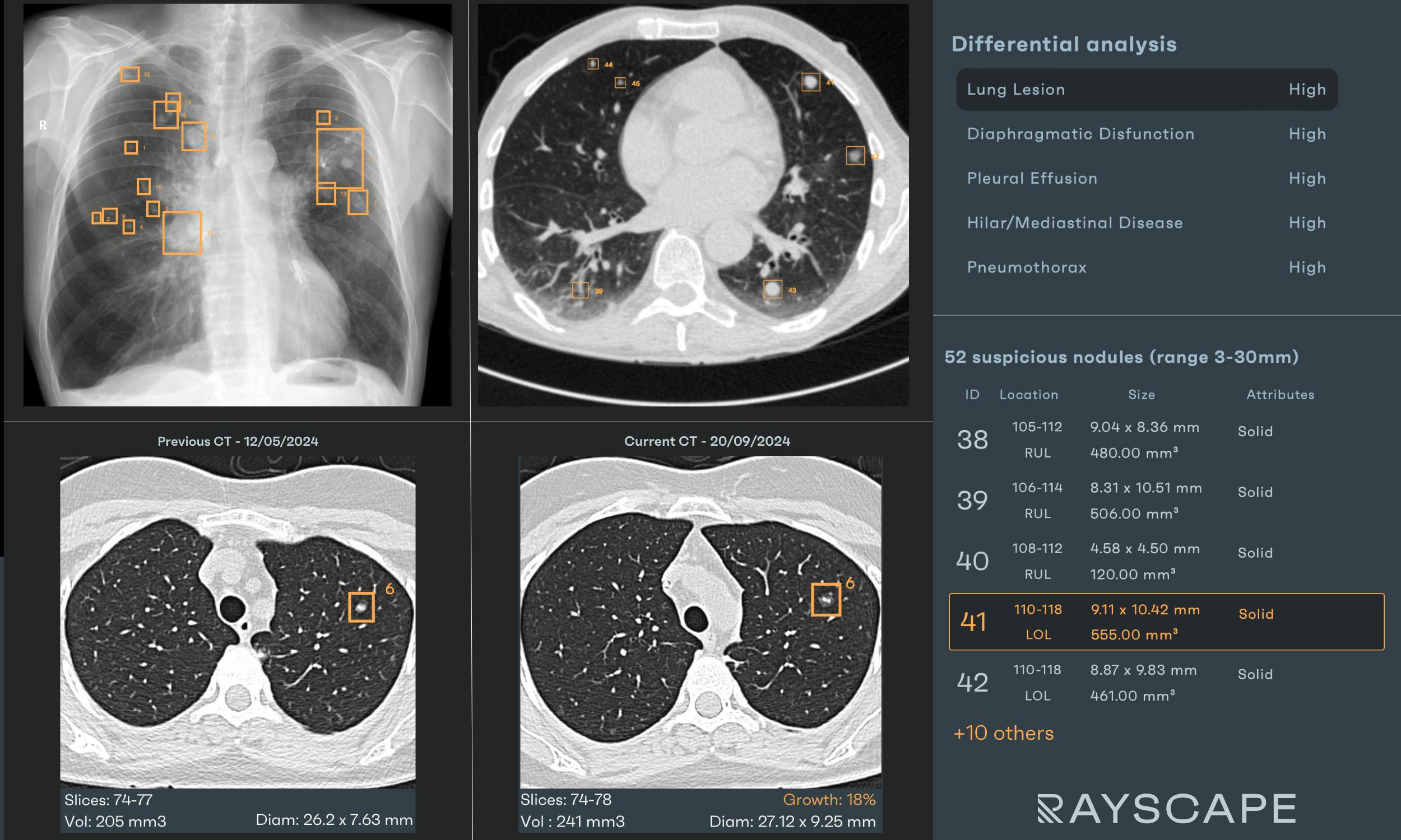 An in-depth look at AI Medical Image Processing in Radiology