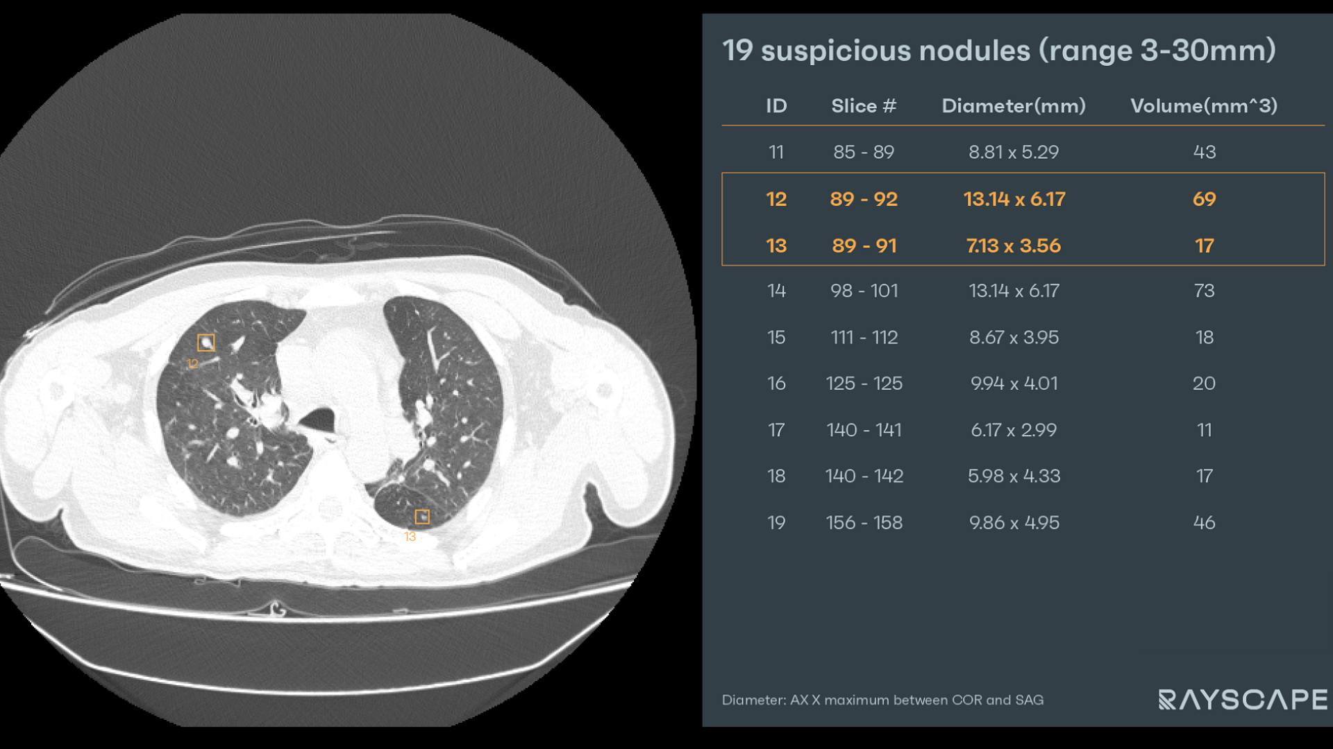 Rayscape | Radiology AI