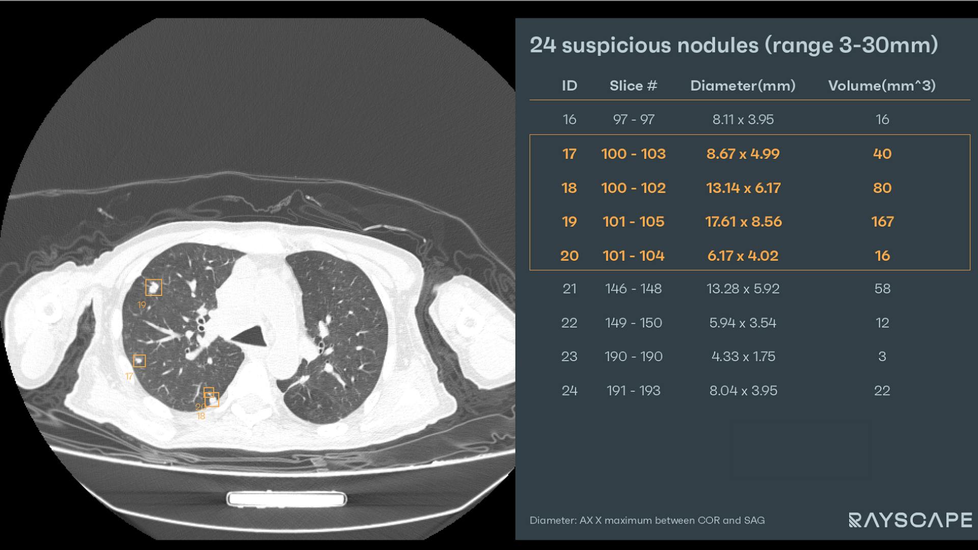 Rayscape | Radiology AI