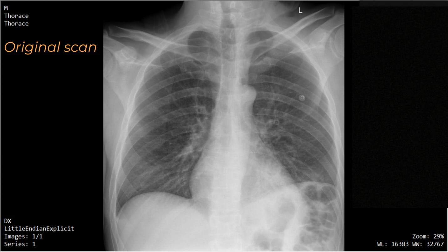 Rayscape | Radiology AI