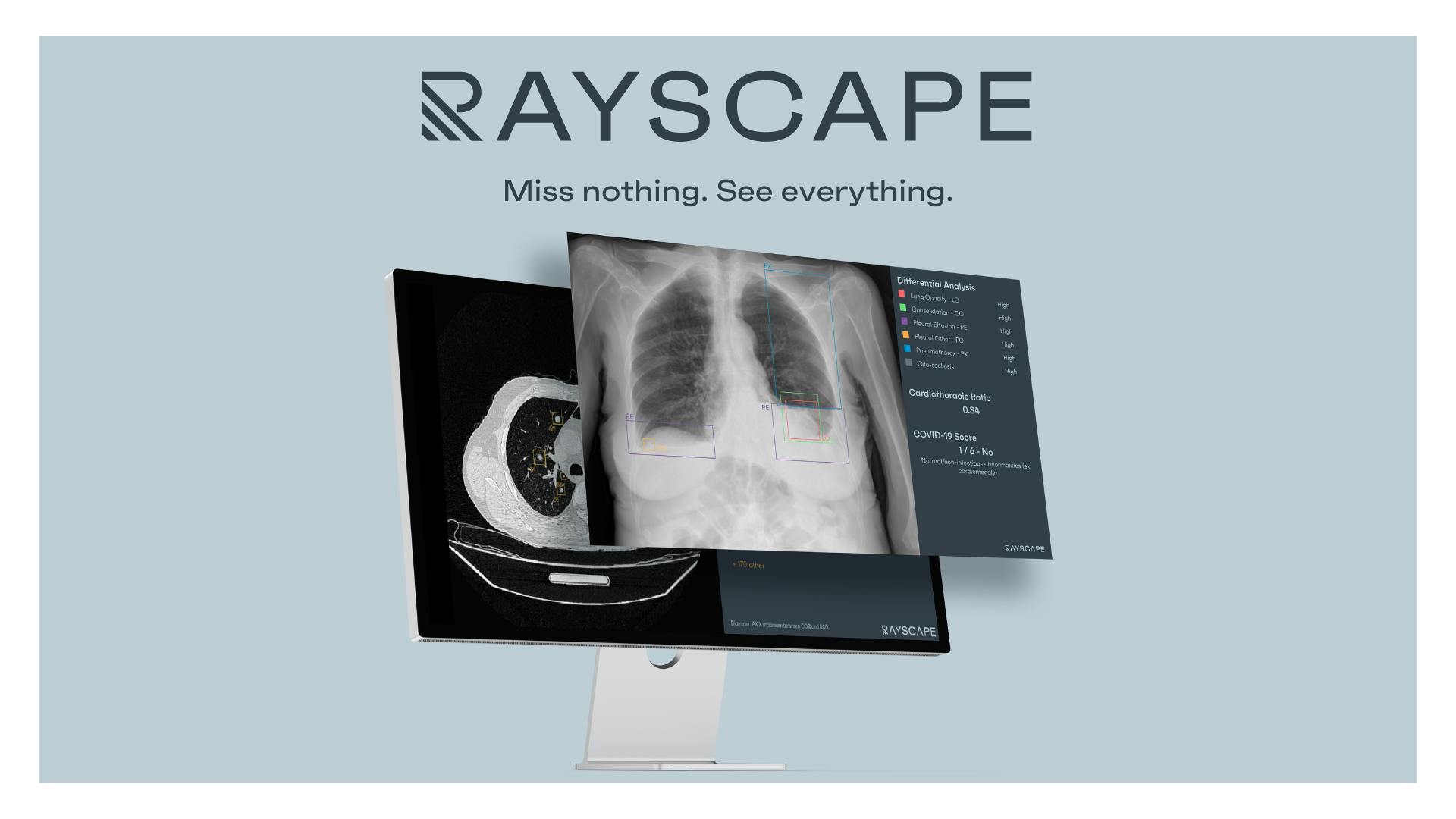 Rayscape | Radiology AI
