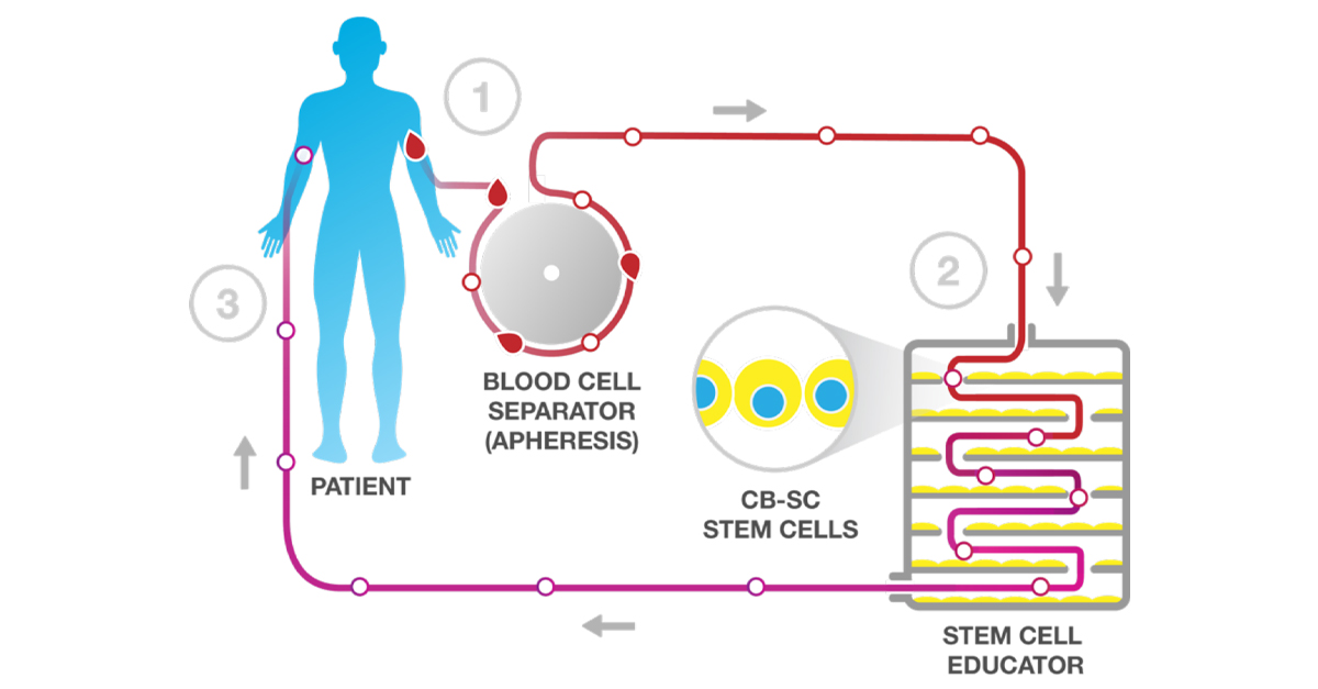 Breakthrough stem cell therapy opens new treatment paths for autoimmune ...