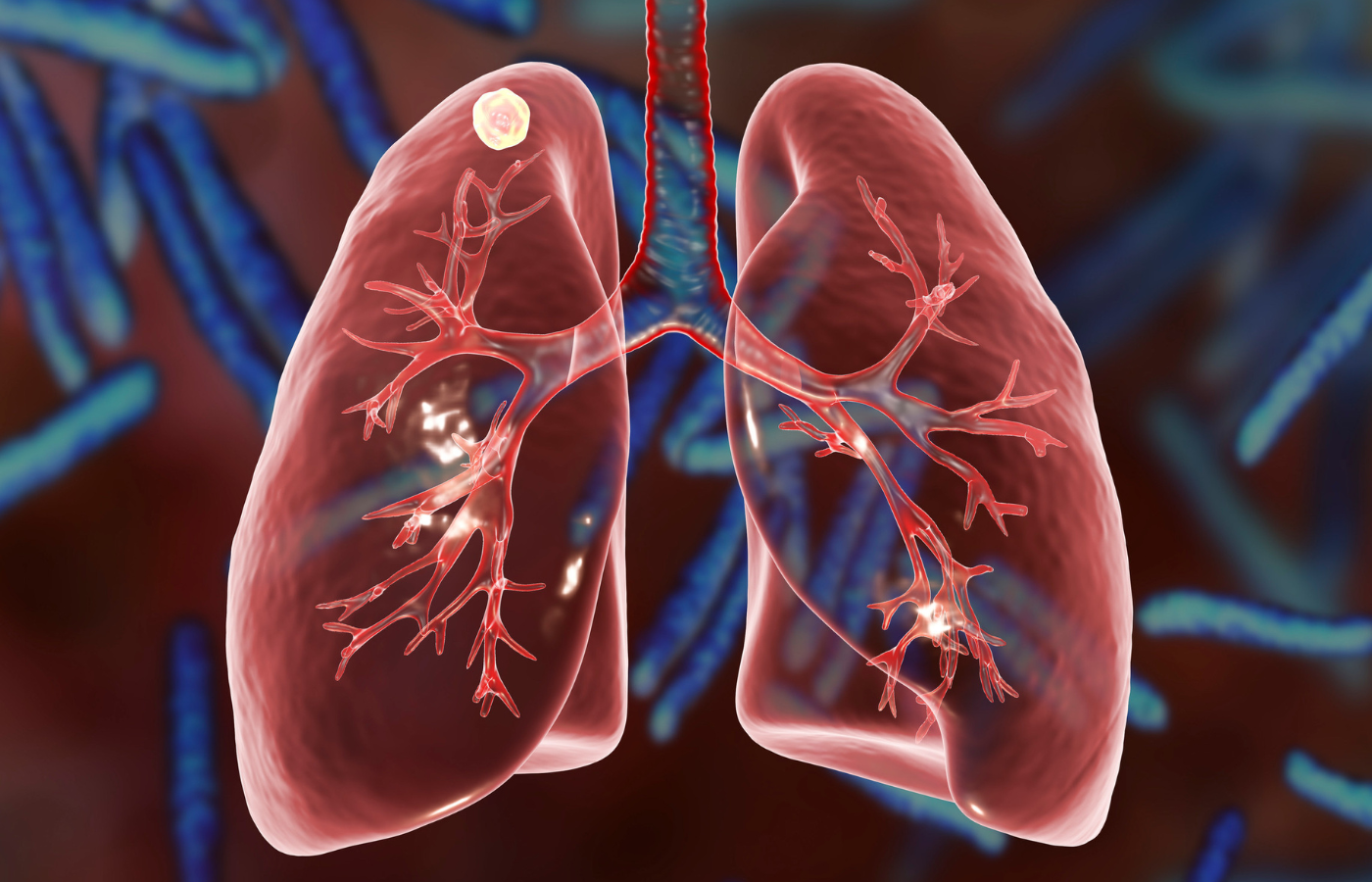 GERD Respiratory Symptoms: Stop the Struggle, Breathe Easy (UK) - RefluxUK