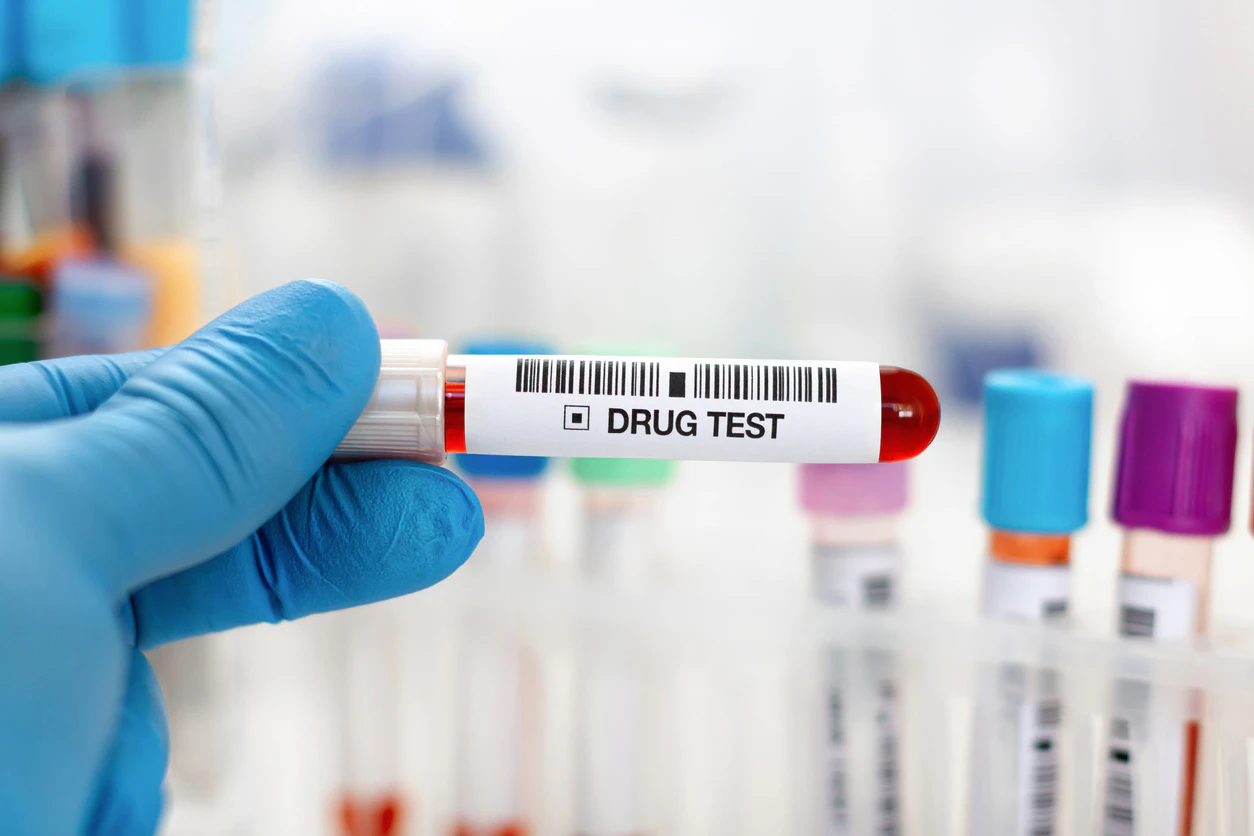 Pros and Cons of Workplace Drug Testing - ScoutLogic