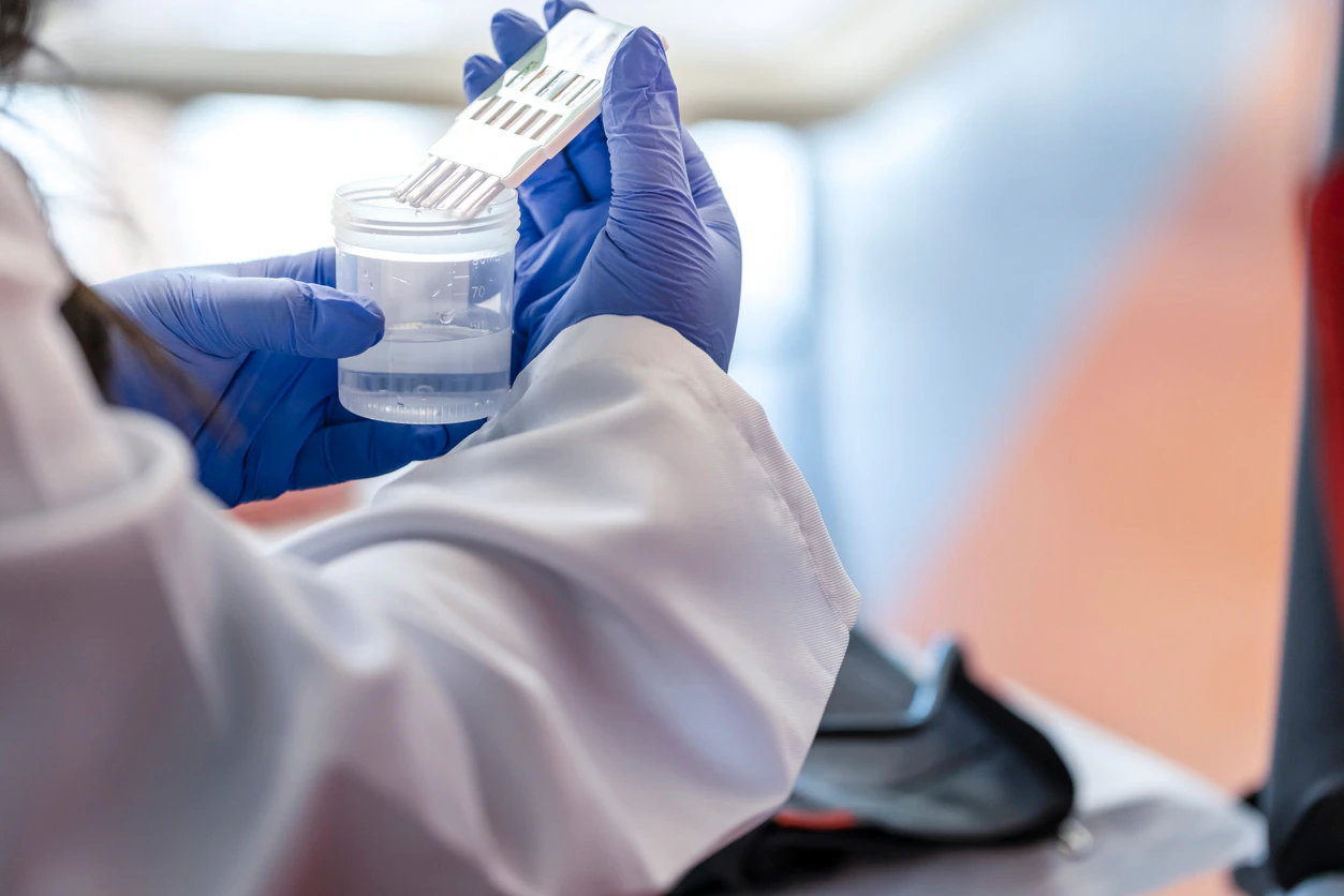 Random Drug Testing at Work: Rights & Compliance - ScoutLogic