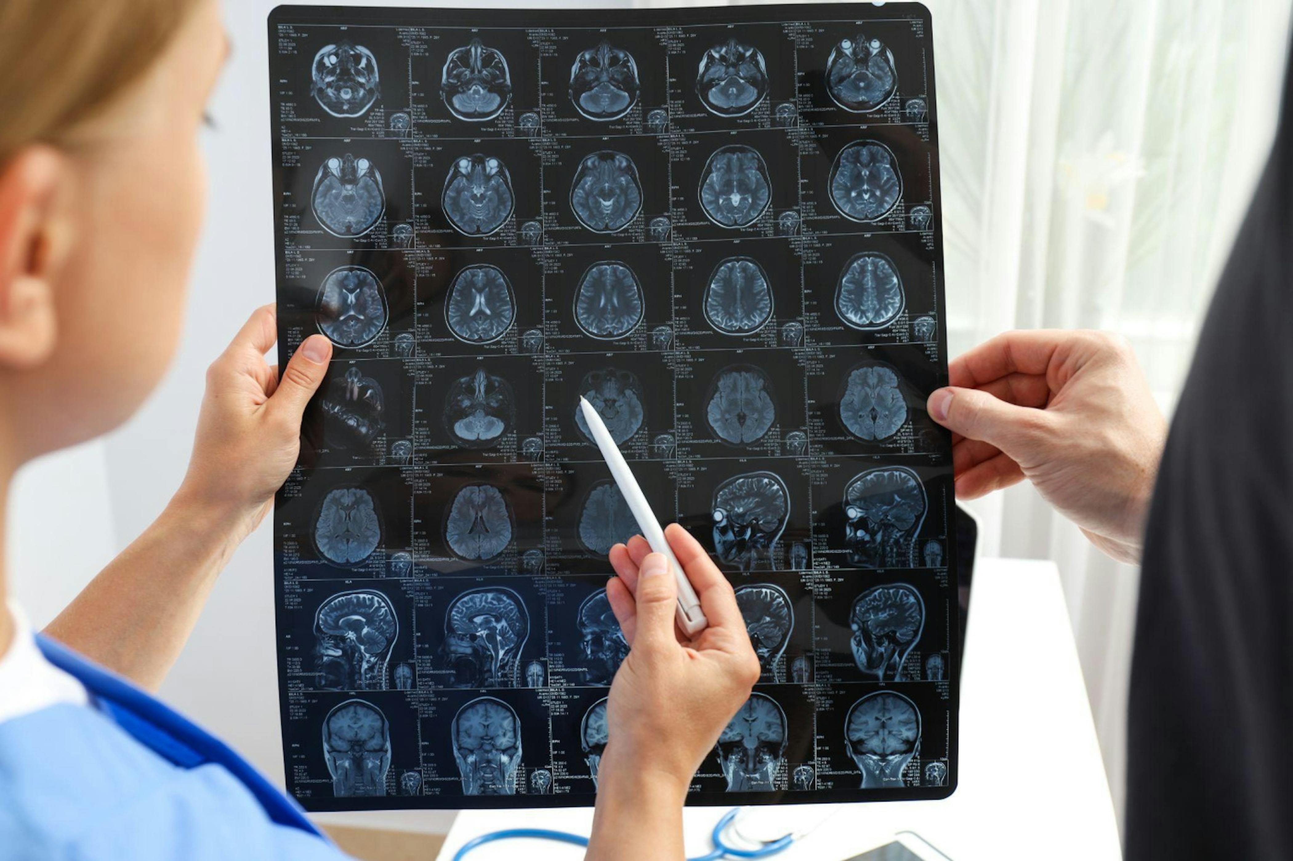 Signs of an Internal Injury After a Car Accident in Minnesota - SiebenCarey