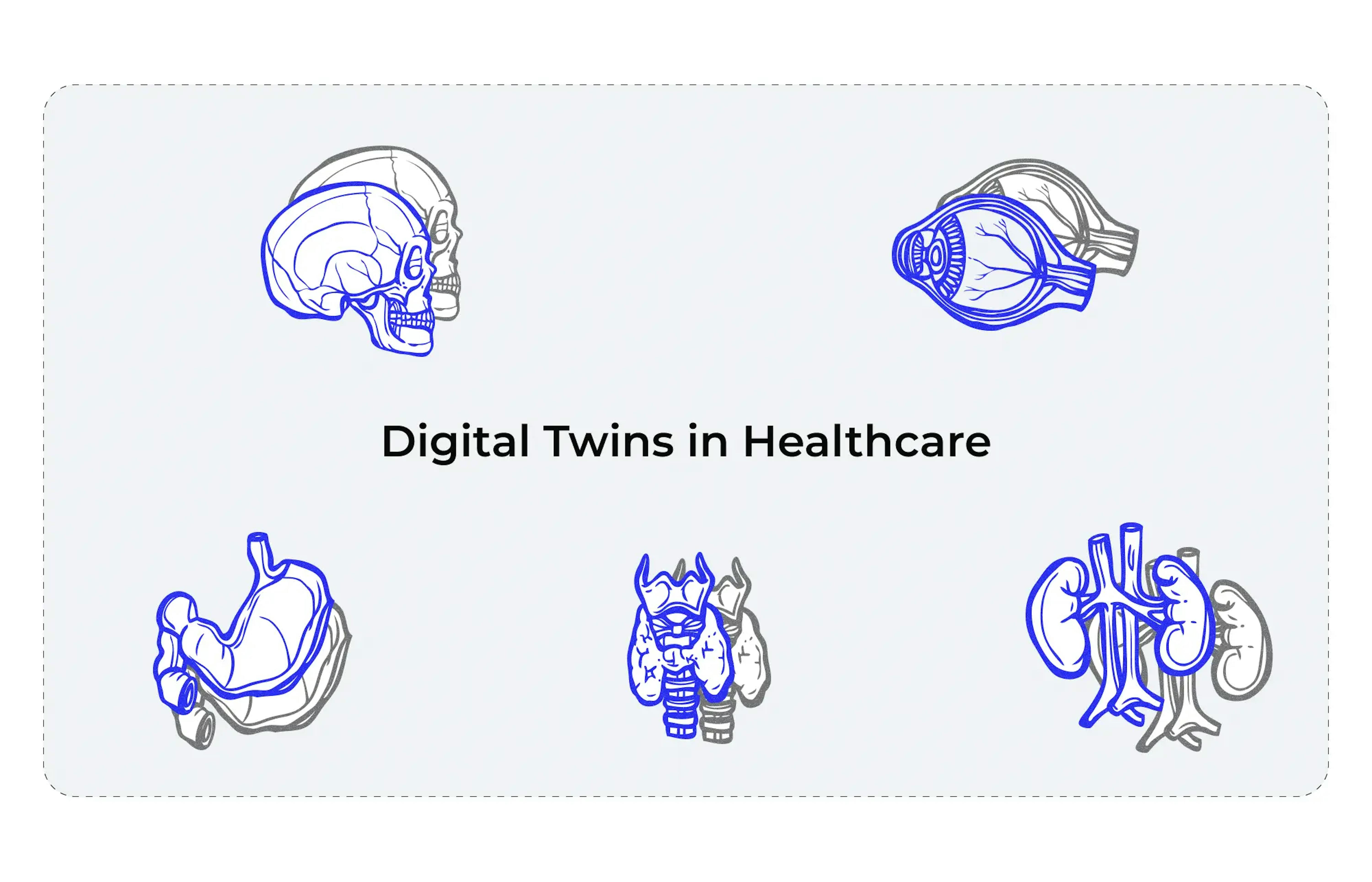Digital Twins in Medicine: Market Overview, Key Apps and Future Trends