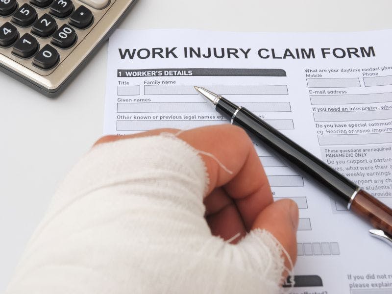 Burn Injuries Caused by Accidents at Work | Switalskis