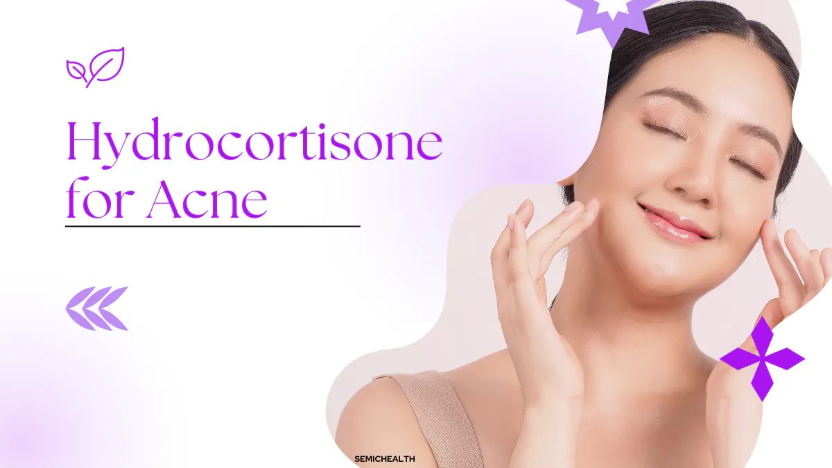 Hydrocortisone (steroid) cream for acne: Is it safe and effective?