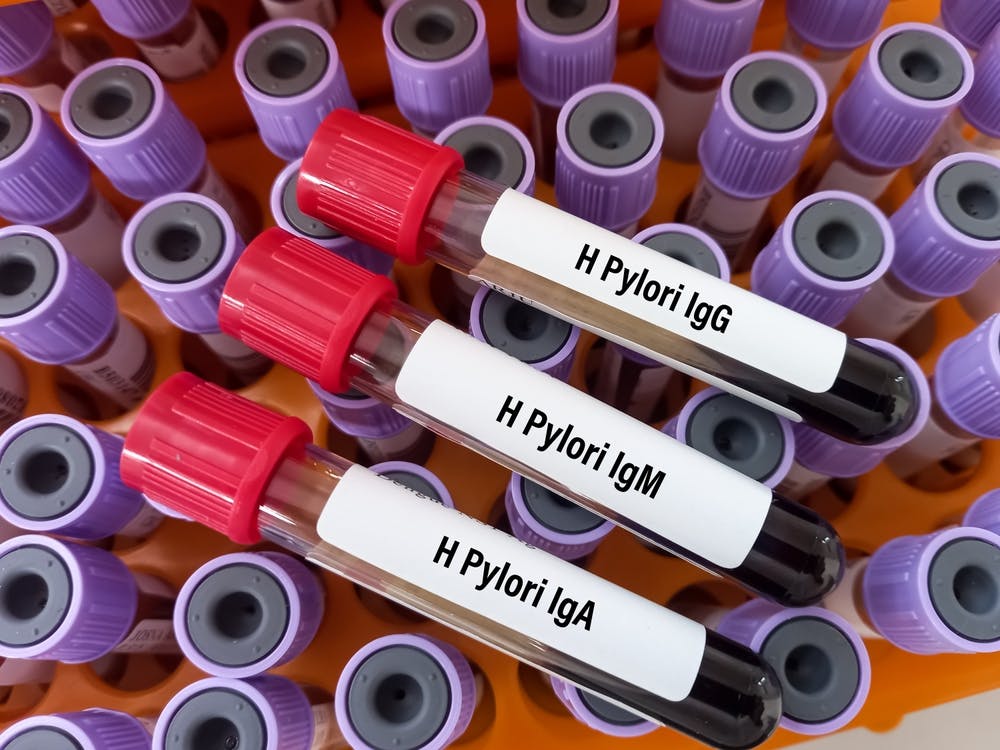 How does the H. pylori urea breath test work?