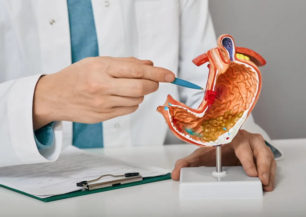 Stomach ulcer vs stomach cancer