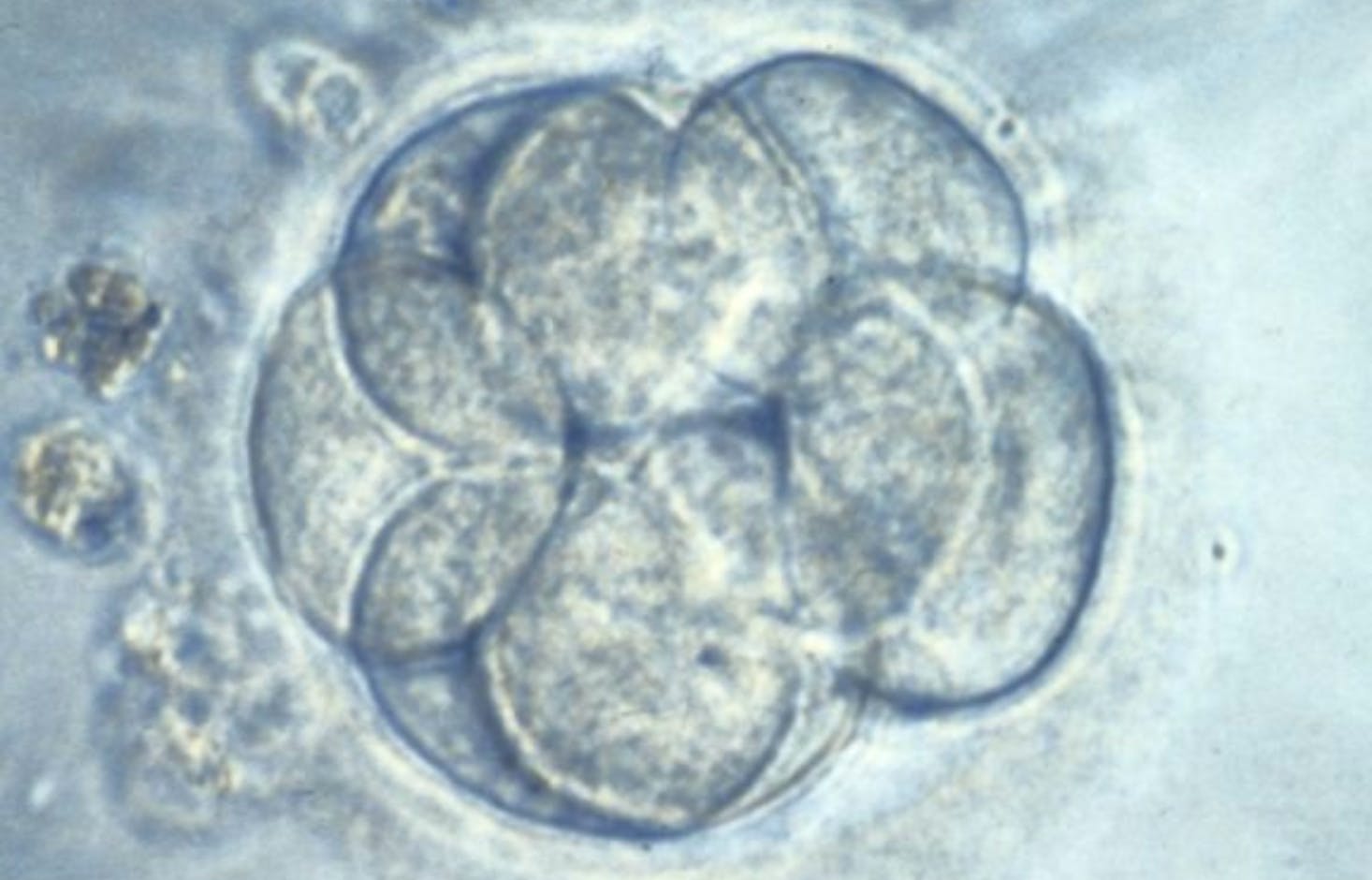 Growing embryos - Embryo grading & PGT-A | Tilly Blog