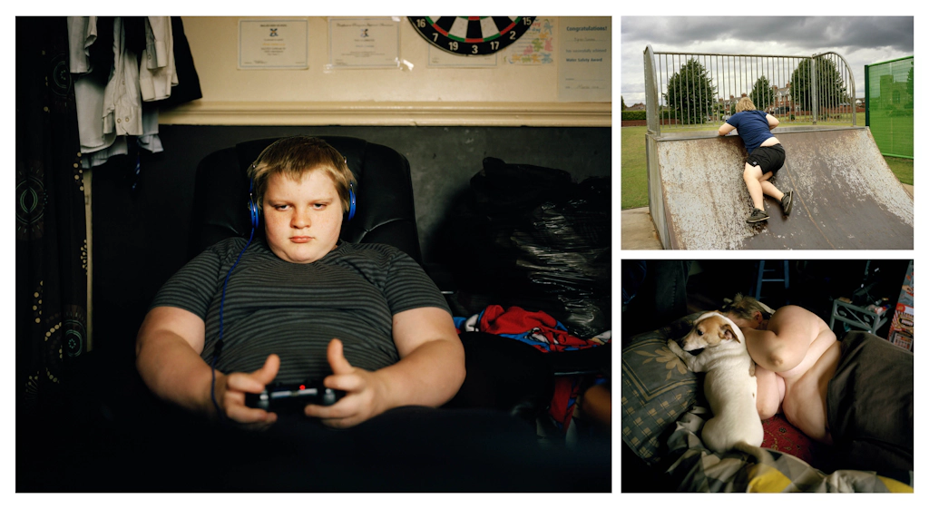 Obesity and Britain’s boys | Wellcome Collection
