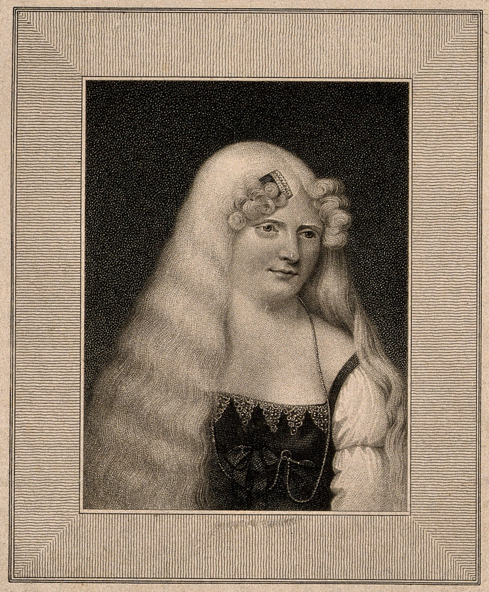 A personal history of albinism | Wellcome Collection