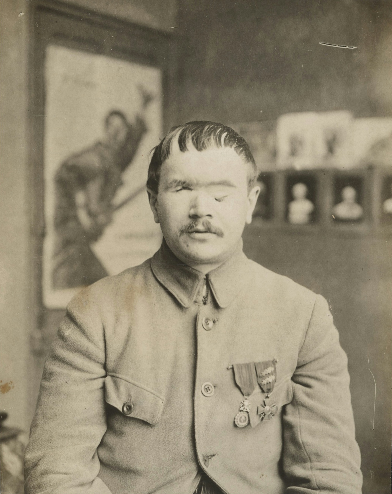 War and disfigurement | Wellcome Collection