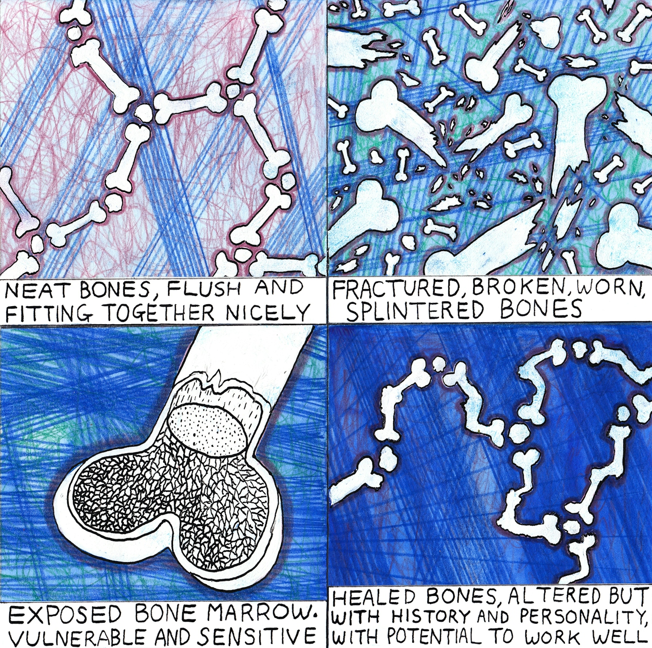 Bones | Wellcome Collection