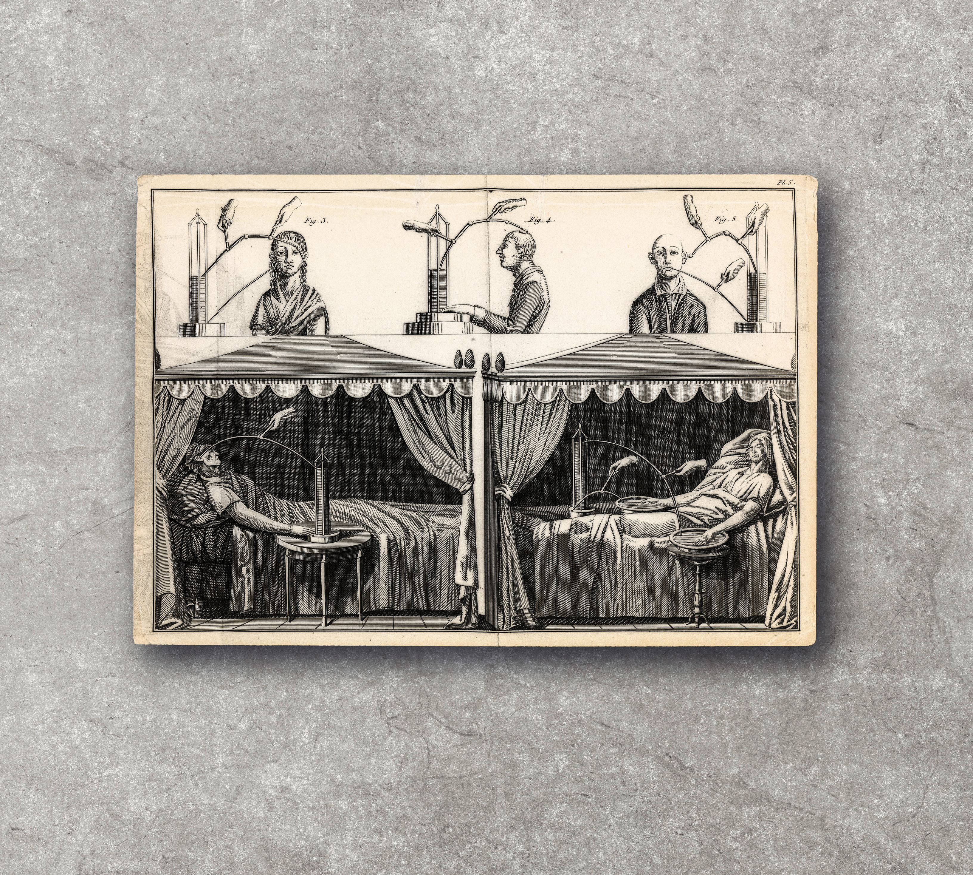 The original drama of operating theatres | Wellcome Collection