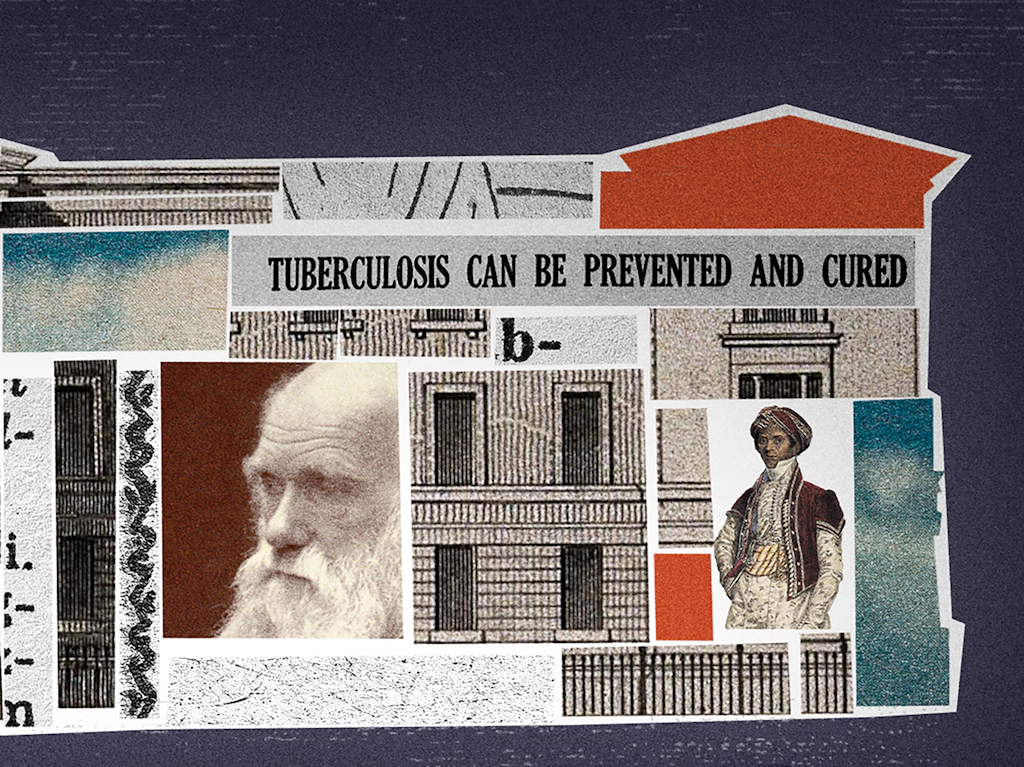 How tuberculosis became a test case for eugenic theory | Wellcome ...