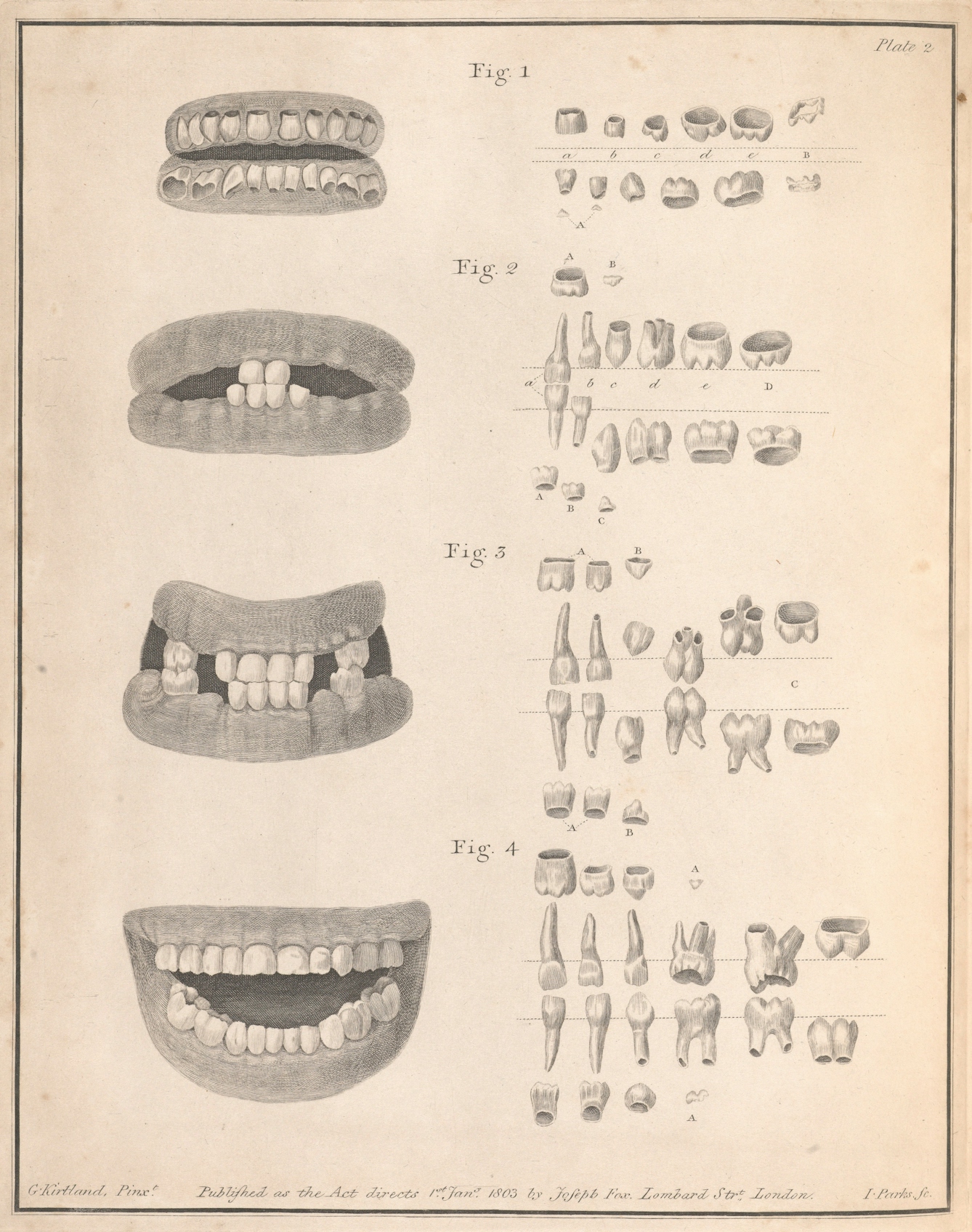 The secrets your teeth hold | Wellcome Collection