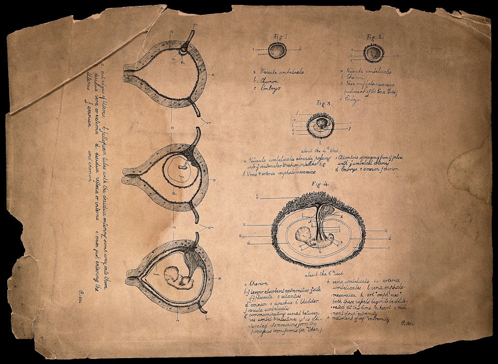 Imagining the foetus | Wellcome Collection