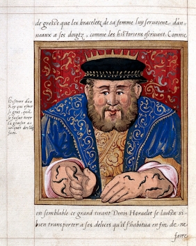 Shakespeare and the four humours | Wellcome Collection