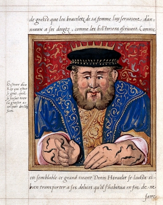 Shakespeare and the four humours | Wellcome Collection