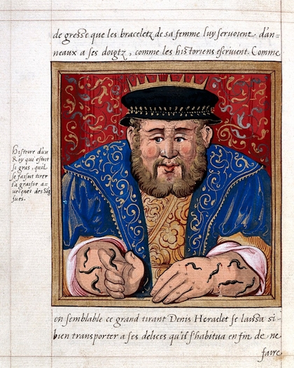 Shakespeare and the four humours | Wellcome Collection