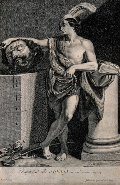 A body apart from the head | Wellcome Collection