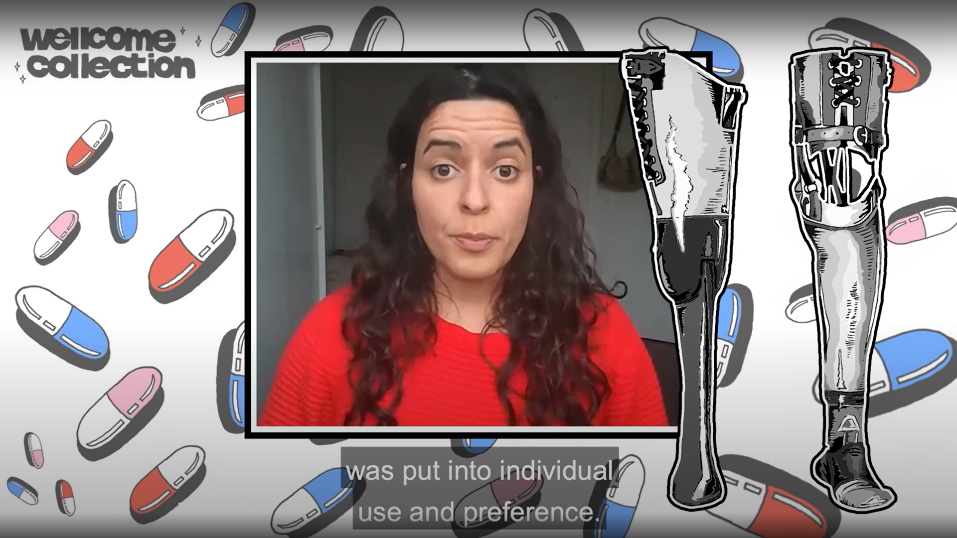 Treatment and rehabilitation in the early 20th century: Prosthetic limb ...