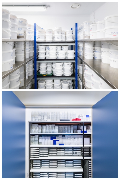 The anatomy of a brain dissection | Wellcome Collection