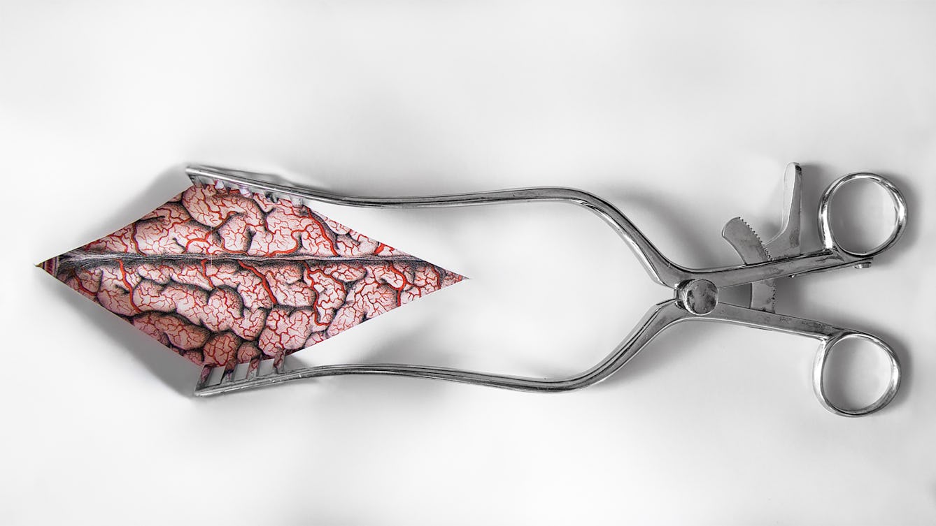 Revolutions in surgery | Wellcome Collection