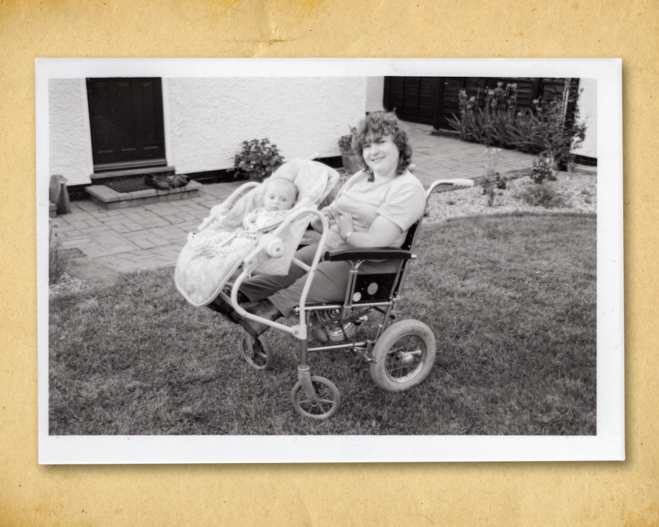 Thalidomide survivors in the 21st century | Wellcome Collection