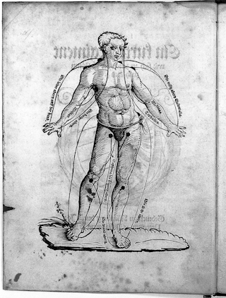 Bloodletting at the barber-surgeon’s | Wellcome Collection