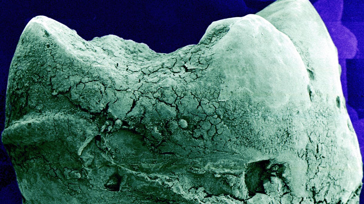 The secrets your teeth hold | Wellcome Collection