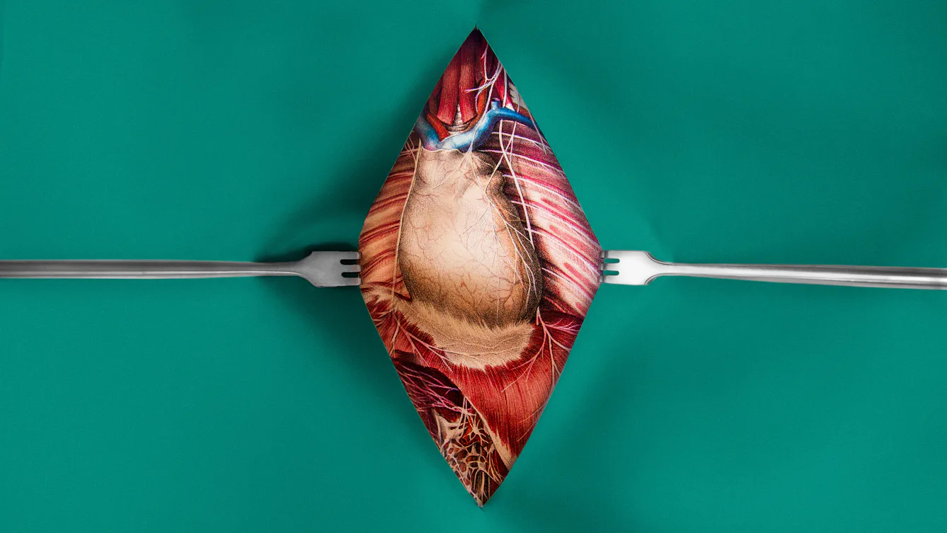 Revolutions in surgery | Wellcome Collection