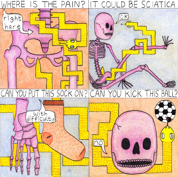 Sciatica | Wellcome Collection